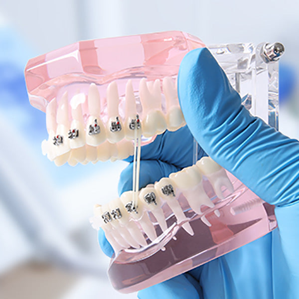 Orthodontics Supplies – pairaydental