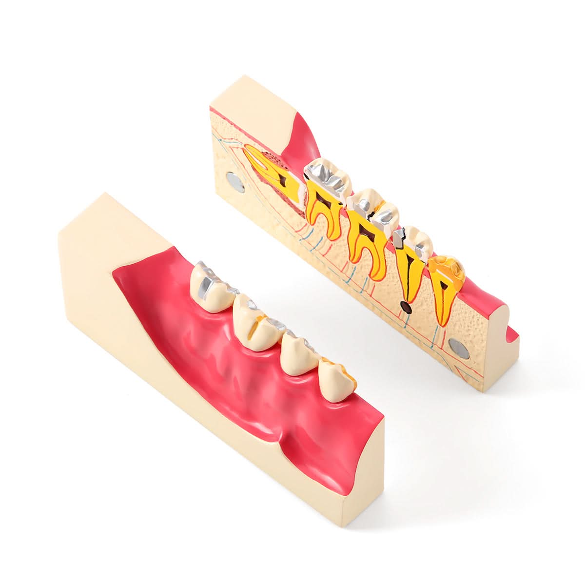 Dental Model